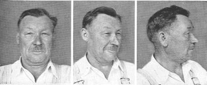 Europidi – Lombarditas